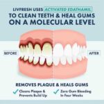 LivFresh Toothpaste Review: The Secret to Healthy Gums?